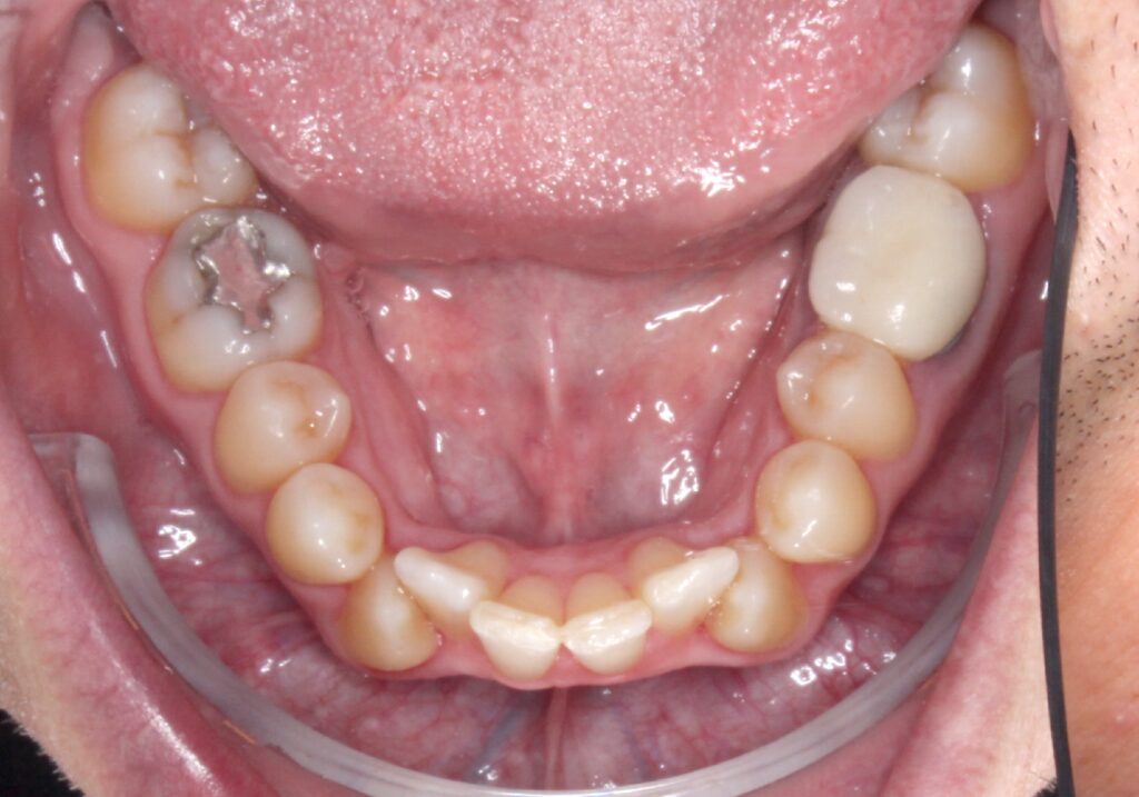 Common Orthodontic Problems San Antonio TX | Alamo Ranch Orthodontics